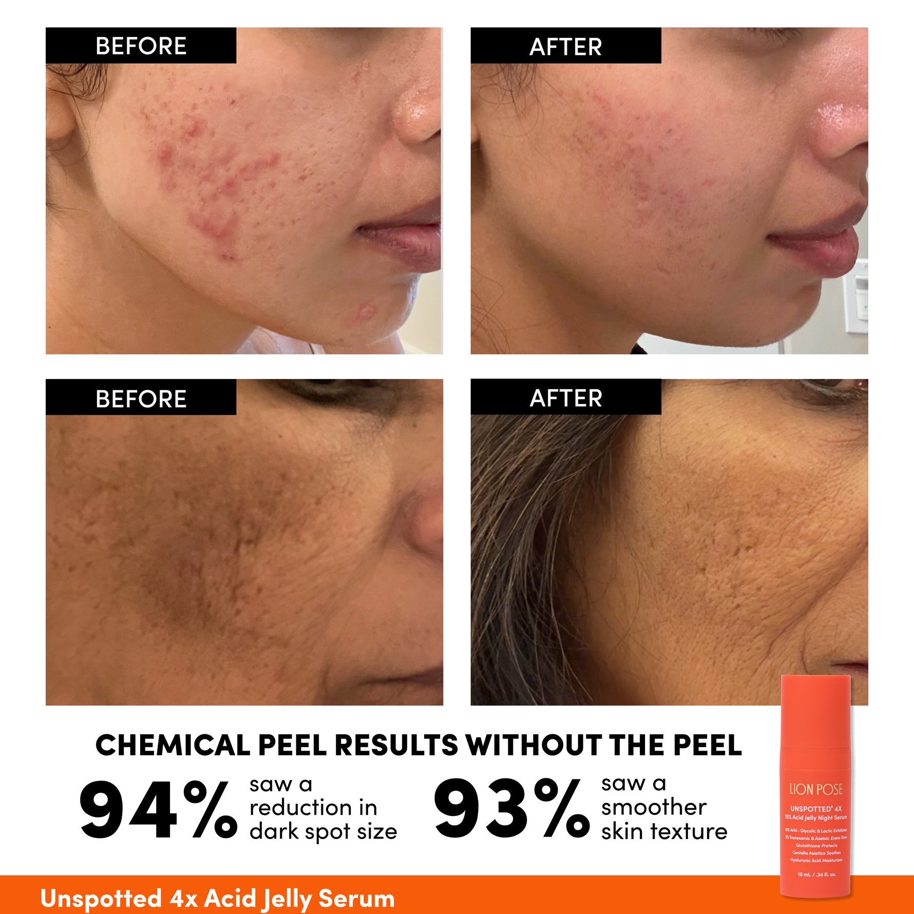 MANE SQUEEZE AHA+SPF Bundle – Lion Pose